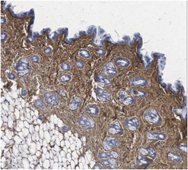 Anti-Decorin Antibody | ABT274